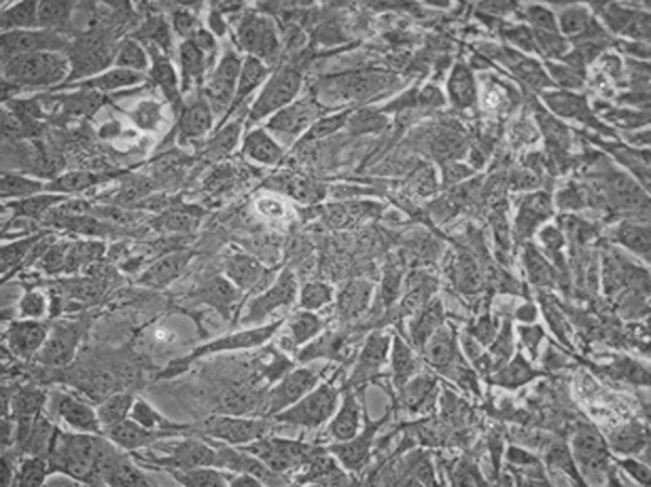 MS5-hDLL1 Stromal Cell Line | SCC167